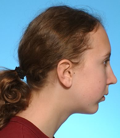 Index of /modules/modulefiles/dswmedia/patternsfacialgrowth/images